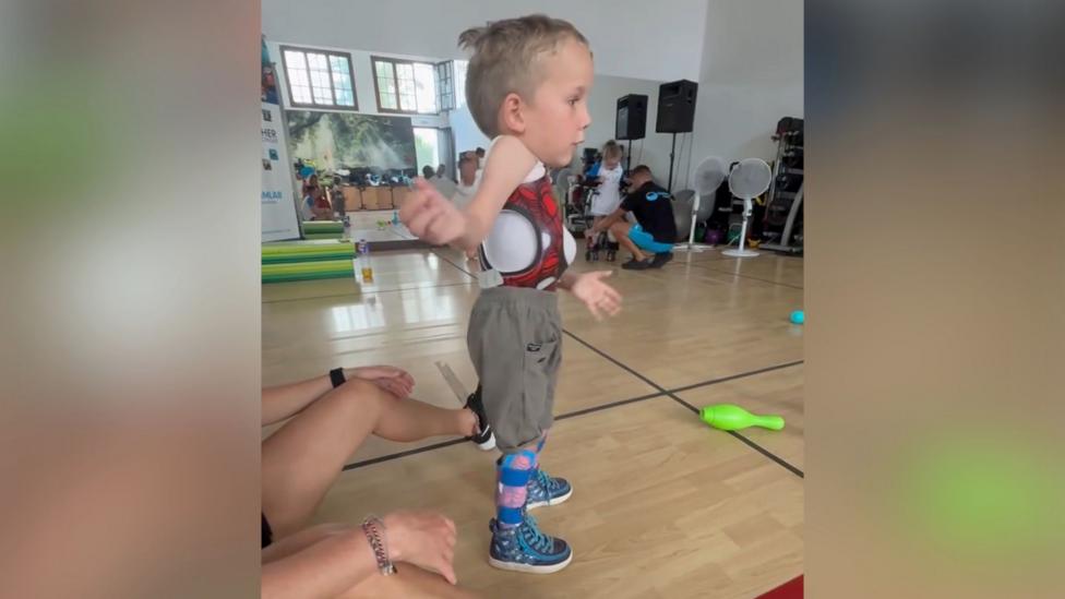 Boy with SMA given £1.8m drug has new lease of life - BBC News