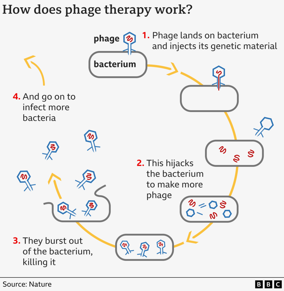Phage therapy: I found a bacteria-eating virus in my loo - BBC News