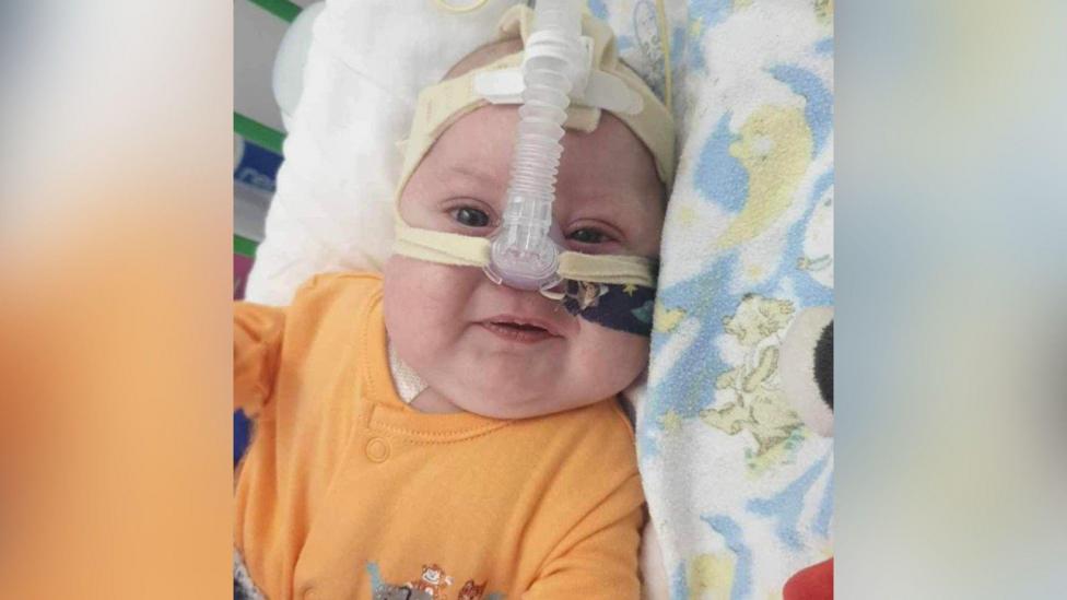 Doctors admit baby's brain damage was preventable - BBC News