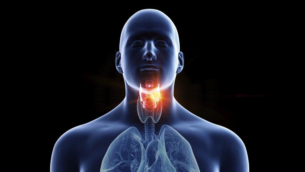 persistent sore throat
