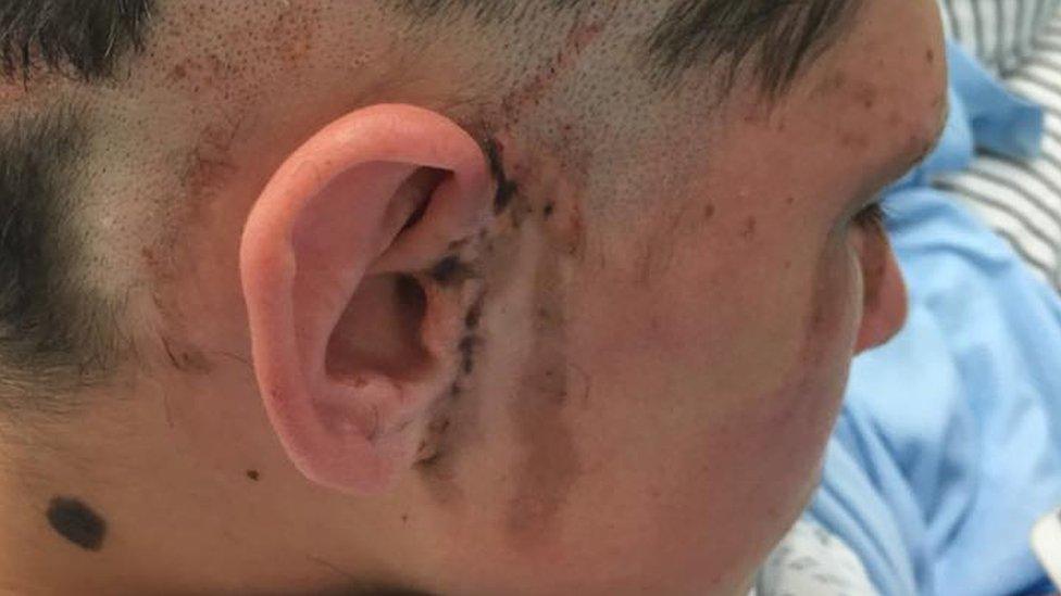 Teen arrested in South Ockendon acid attack probe - BBC News