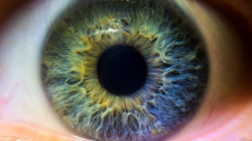 World's first complete eye transplant takes place in US - BBC Newsround