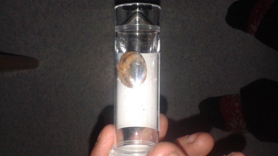 Derby button battery girl Kacie Barradell home after ordeal - BBC News