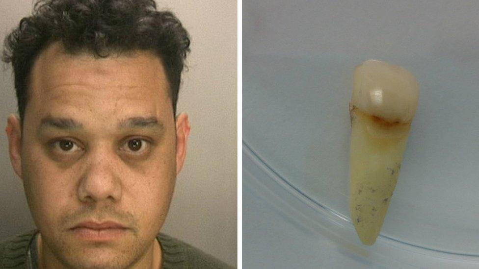 Burglar caught after tooth lands in dirty washing - BBC News