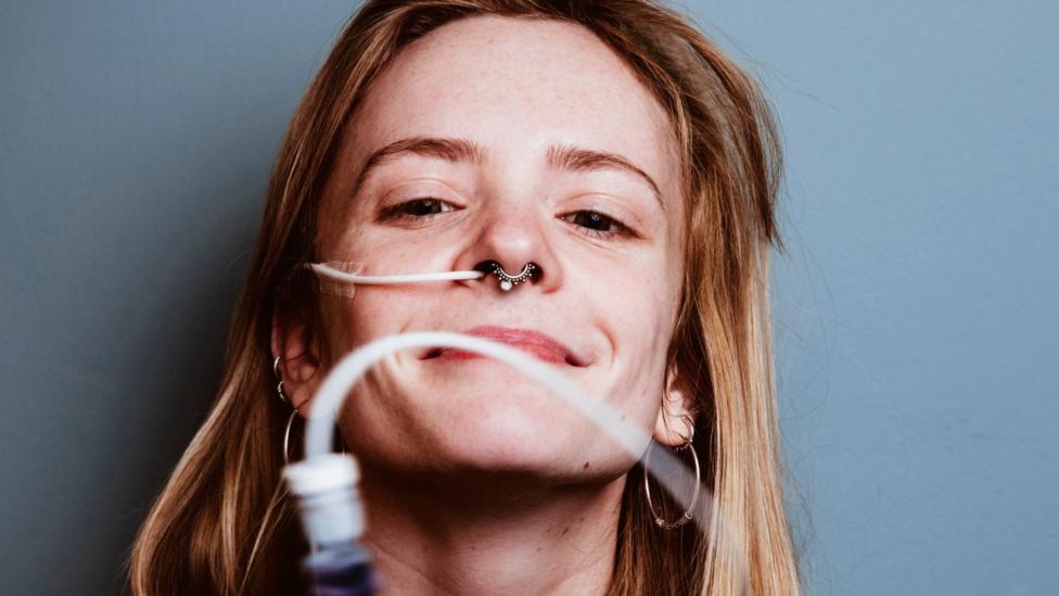 ‘If only I’d found out earlier I had pelvic congestion syndrome’ - BBC News