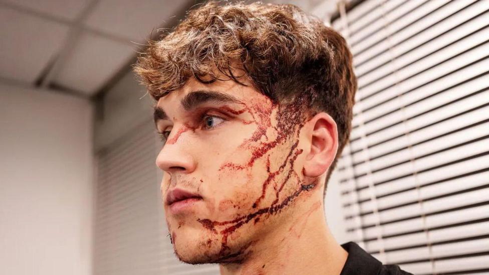 Barcelona defender Pau Cubarsi 'fine' after needing 10 stitches ...