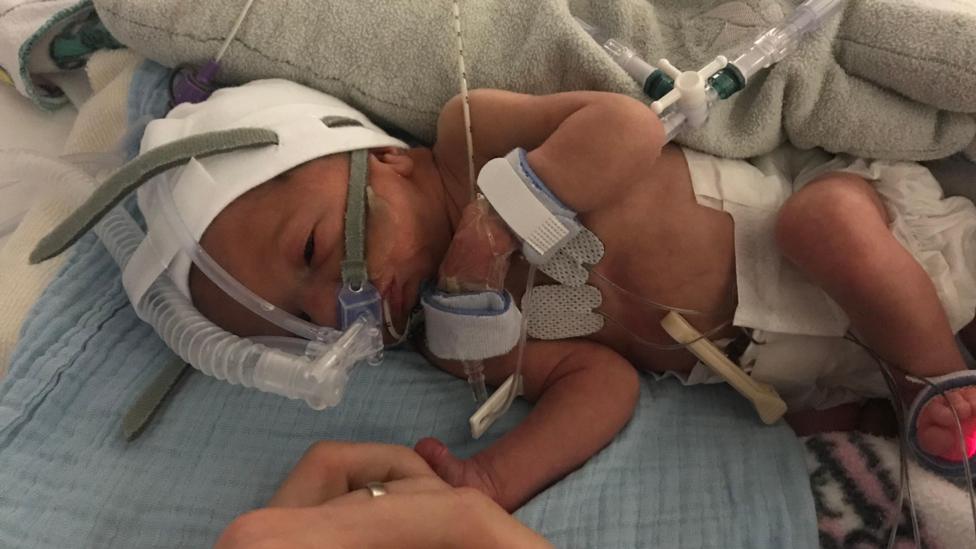 'It's such a hard time' - Parents of premature babies welcome extra ...