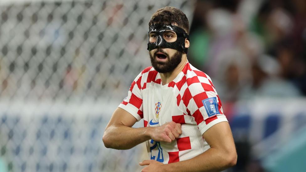 Kylian Mbappe: 11 iconic images of great players in masks - BBC Sport