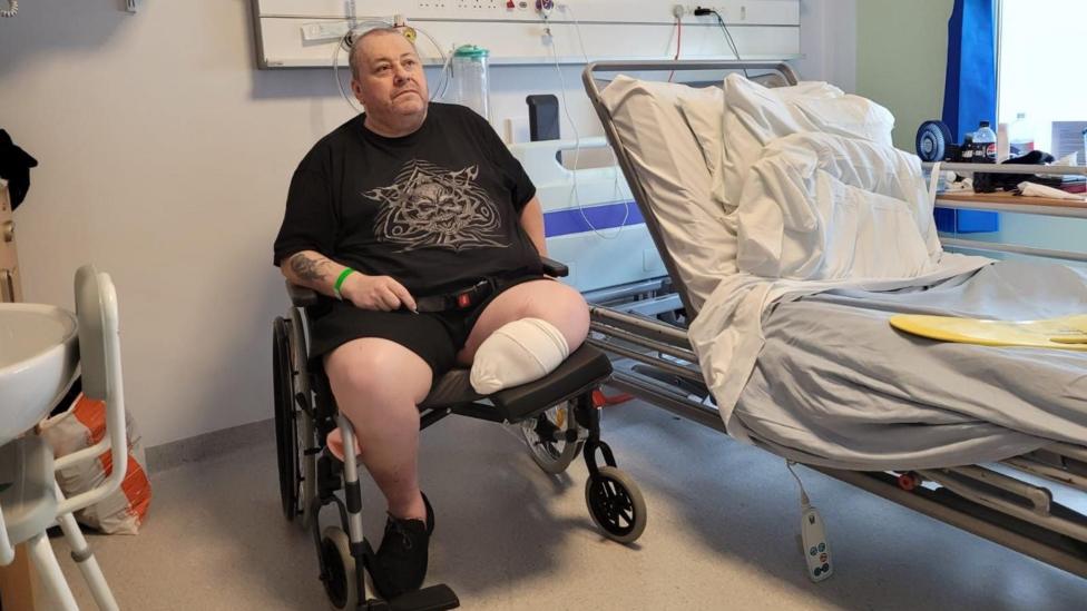 Patient 'stuck' in West Yorkshire hospital after leg amputation - BBC News