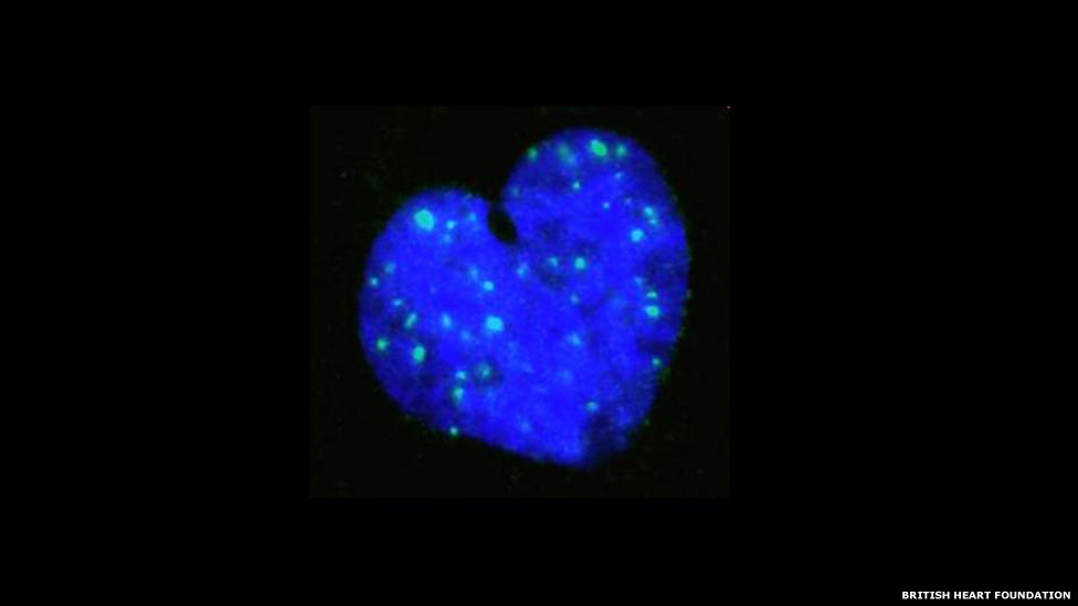 In pictures: Inside the heart - BBC News