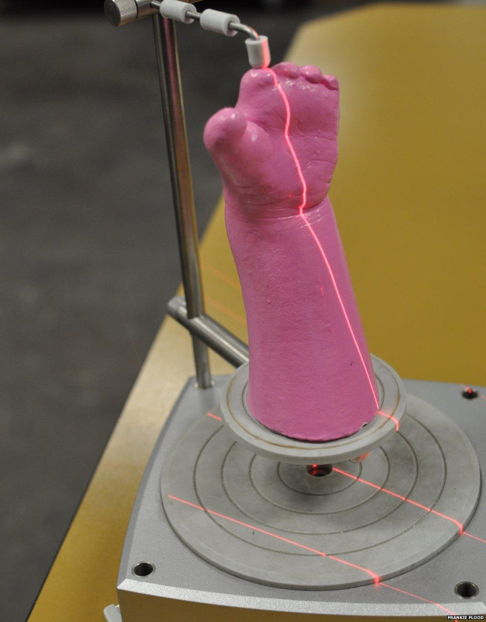 Handy work: The making of Hayley Fraser's new hand - BBC News