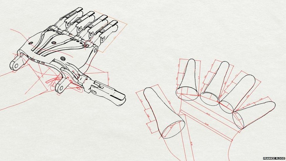 Handy work: The making of Hayley Fraser's new hand - BBC News