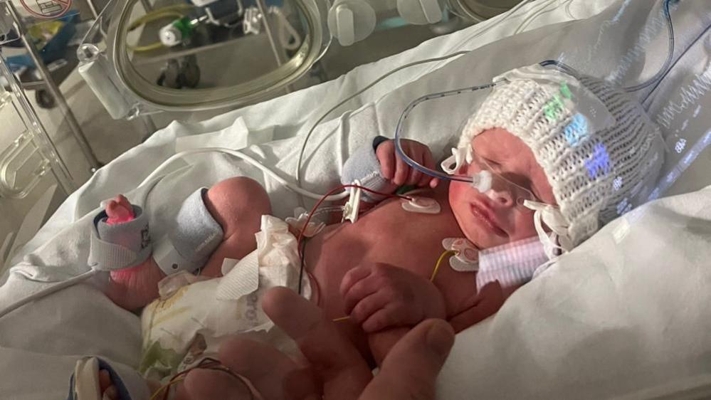 Upper Lighthorne parents highlight rare condition TOF in newborns - BBC ...