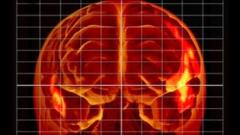 La gente distraída tiene "mucho cerebro" - BBC News Mundo