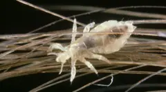 Imagem microscópica de um piolho em fios de cabelos. 
