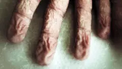 Kulit di ujung jari tangan dan kaki kita mengerut setelah direndam dalam air selama beberapa menit.
