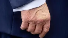 የትራምፕ እጅ