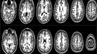 Cómo los científicos quieren impedir que te puedan hackear el cerebro ...