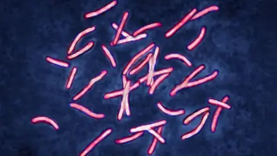 Descubierto el misterio del "cocoliztli", la epidemia que mató a ...