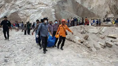 Penyakit mumps: Ribuan anak terinfeksi penyakit gondongan – Apa itu ...