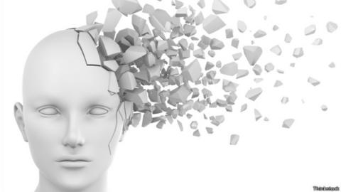 ¿Cómo es vivir con el síndrome de la cabeza explosiva? - BBC News Mundo