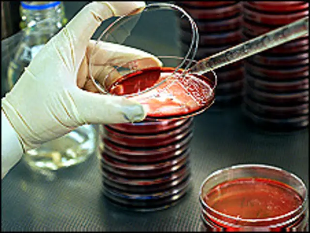 Esperanza en Venezuela contra el cáncer - BBC News Mundo