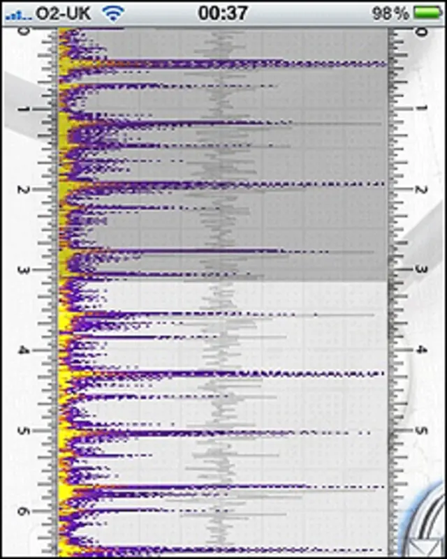 El iPhone, ¿el nuevo estetoscopio? - BBC News Mundo