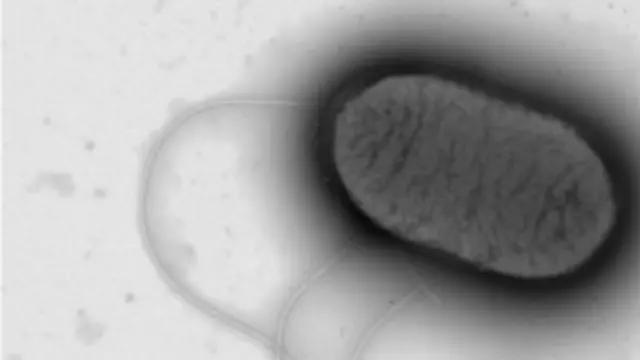 ¿Cuántos microbios hay realmente en el polvo de nuestras casas? - BBC ...