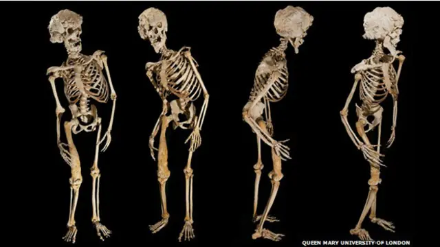 Em busca dos segredos do 'Homem Elefante' - BBC News Brasil