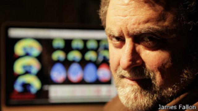 Pesquisador se descobre psicopata ao analisar o próprio cérebro - BBC ...