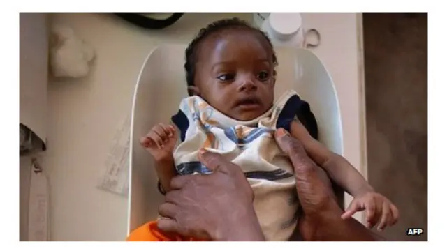 Unicef 230 Milhões De Crianças Não Existem Oficialmente Bbc News Brasil