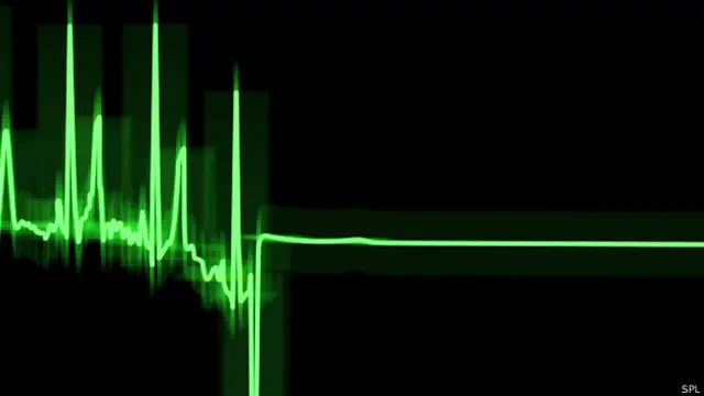 ¿Realmente se puede revivir a alguien con compresiones en el pecho ...