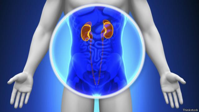 Saiba como é a vida de quem tem apenas um rim - BBC News Brasil