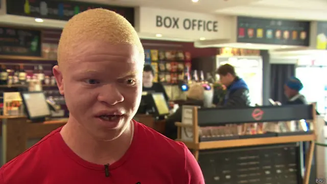 ¿Por qué hay tantos albinos en Puerto Rico? - BBC News Mundo