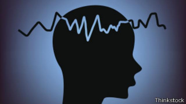 ¿Cómo es vivir con el síndrome de la cabeza explosiva? - BBC News Mundo