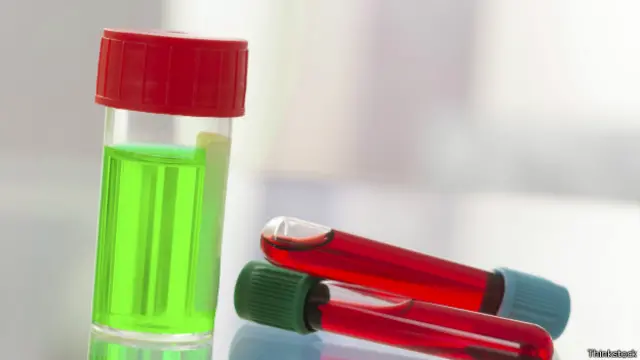 Qué nos dice el color de la orina sobre nuestra salud - BBC News Mundo