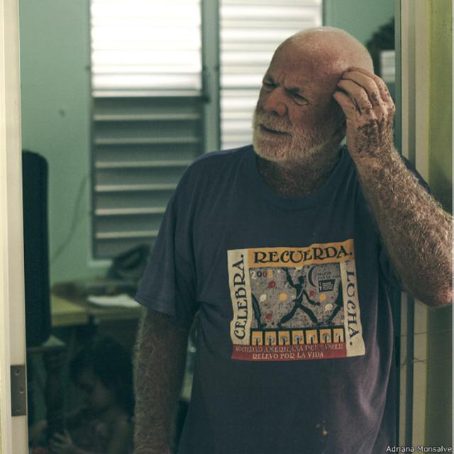 ¿Por qué hay tantos albinos en Puerto Rico? - BBC News Mundo