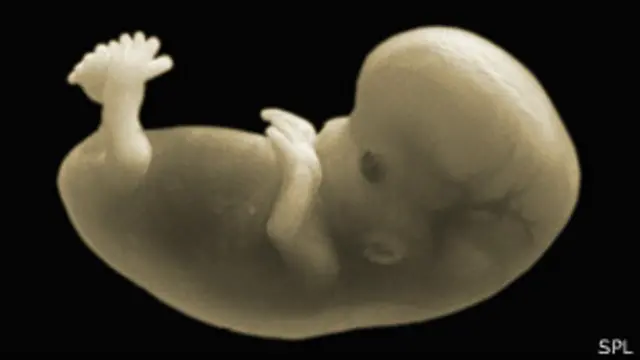 Por qué causa tanta polémica Planned Parenthood y la donación de fetos ...