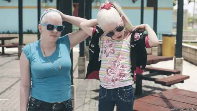 En fotos: La compleja vida de los albinos bajo el apabullante sol de ...