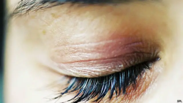 Por que nossos olhos formam a remela? - BBC News Brasil