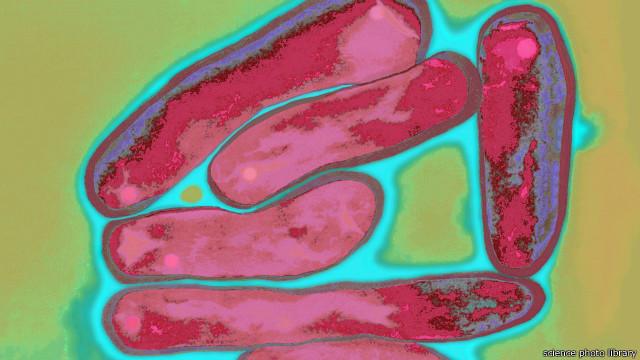 Infeksi TBC sama mematikannya dengan HIV - BBC News Indonesia