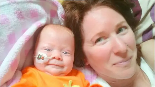 Los médicos que usaron una bolsa de sándwich para salvarle la vida a ...