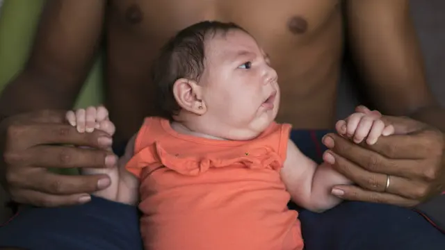 Zika: Primeira mãe de bebê com microcefalia nos EUA teria contraído ...