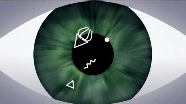 Cuál es el origen de las molestas manchas que flotan en tu campo de ...