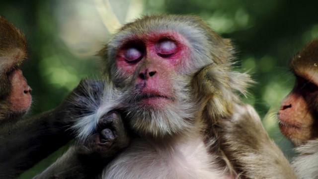 ¿Por qué da tanto placer rascarse? - BBC News Mundo