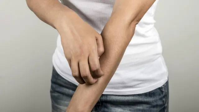 ¿Por qué da tanto placer rascarse? - BBC News Mundo