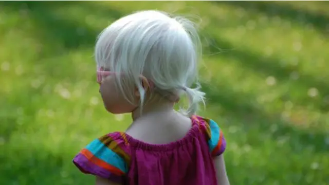 Como Elsa, personagem de 'Frozen', ajudou menina com albinismo - BBC ...