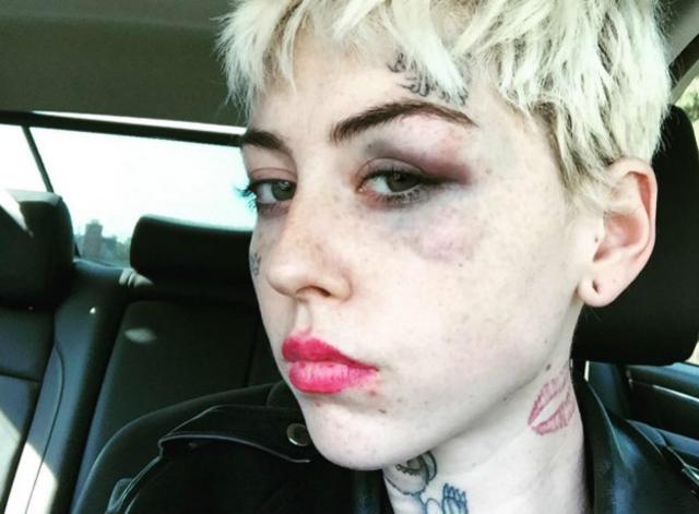 O quadro retratando Trump com pênis pequeno que rendeu agressão a ...