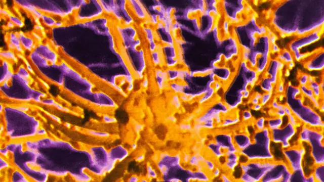 Феромоны: секрет сексуальной привлекательности или заблуждение? - BBC ...