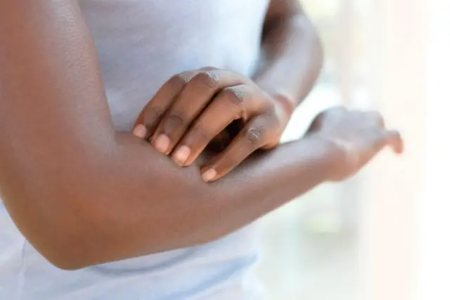 Démangeaisons chroniques : de nouveaux traitements contre cette ...